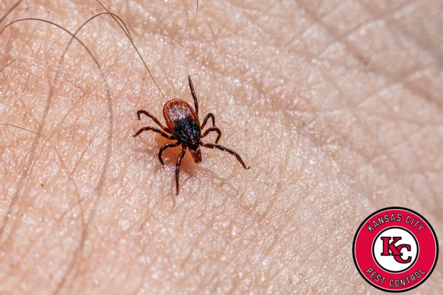 Spider Bite vs. Tick Bite: How to Tell the Difference